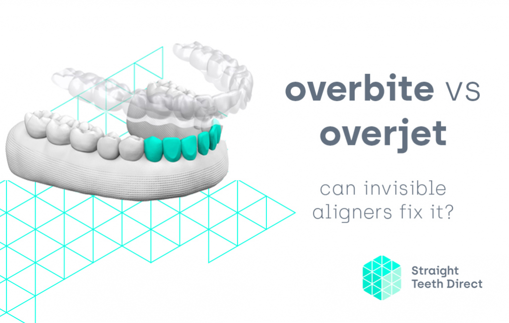 Overjet Vs Overbite What Is What And Can Aligners Improve Them